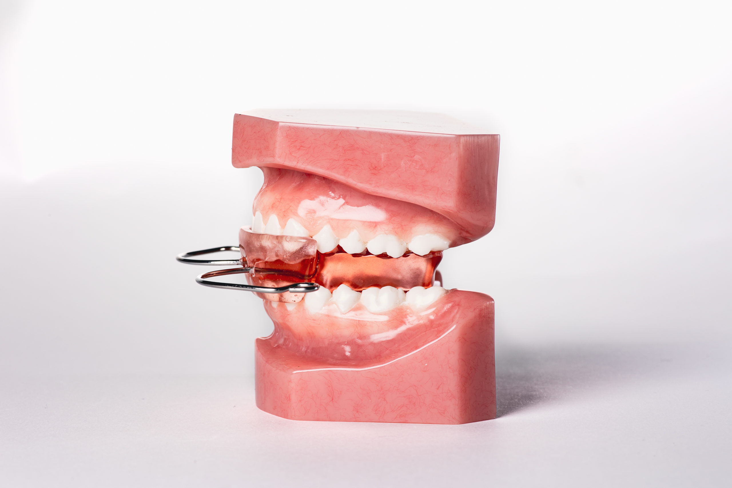 Activator - Beugels bij Ortho Woerden